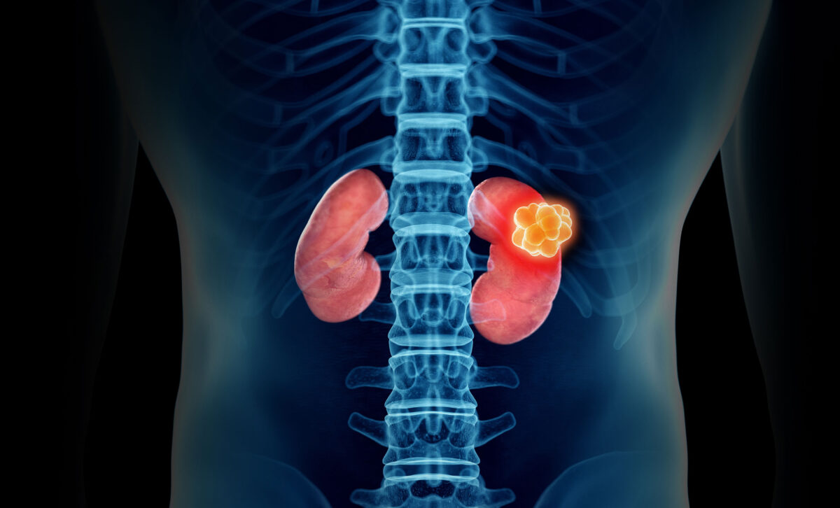 Continuous Home Care - Ascend Hospice Care